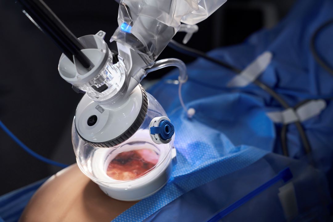 Single-Port Surgery Case Study | Intuitive